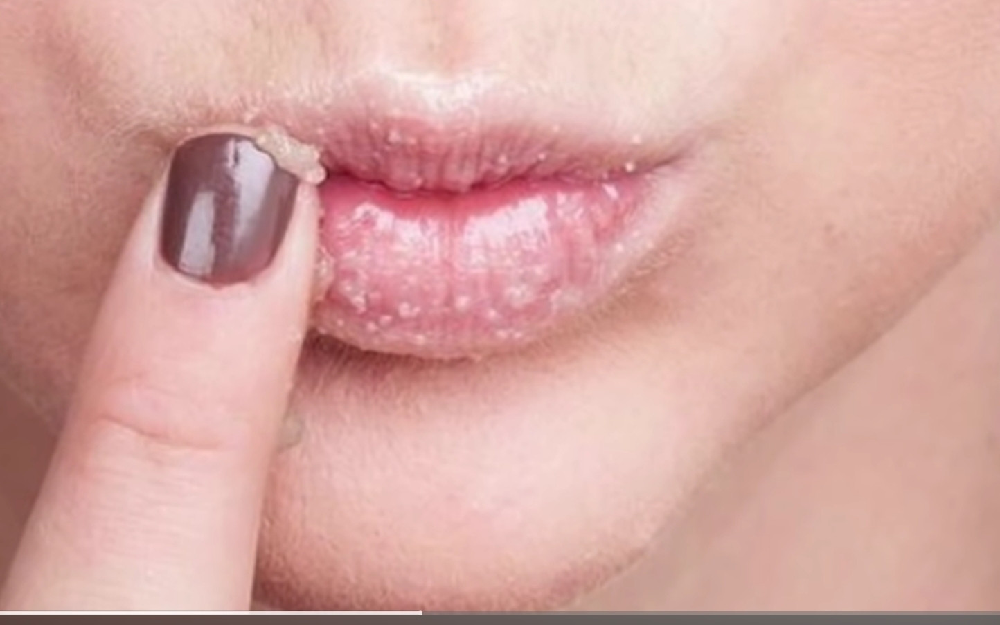 En Etkili Uçuk Kremi Listesi / 10 Mucizevi İlaç